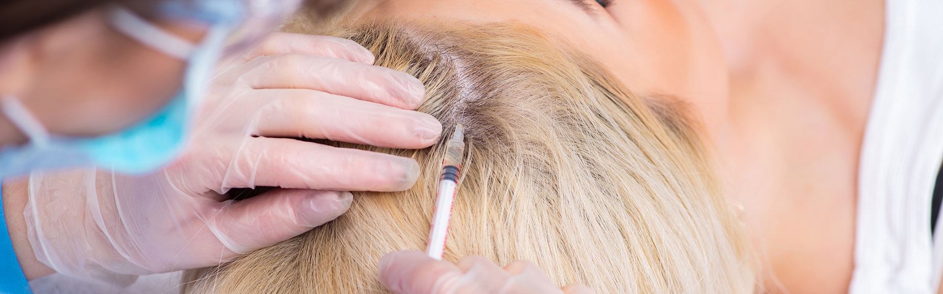Injection de PRP | Hair & Face Clinic — Pathologies des cheveux